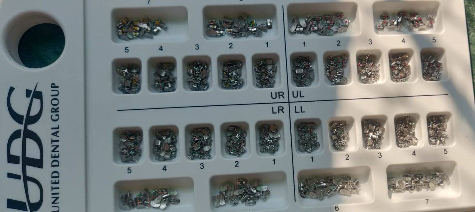 UDG Metal Bracket Bulk Kit-400 Metal Brackets and 160 Buccal Tubes-20 ...